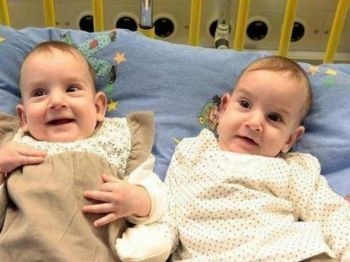 სიამის ტყუპს საქართველოში დახმარება მოუხსნეს - აღარ ეკუთვნისო... - მშობლები